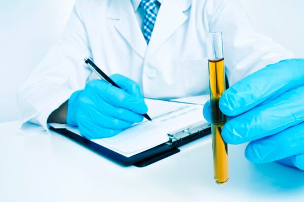Urine Elements Test - Natural Health Group