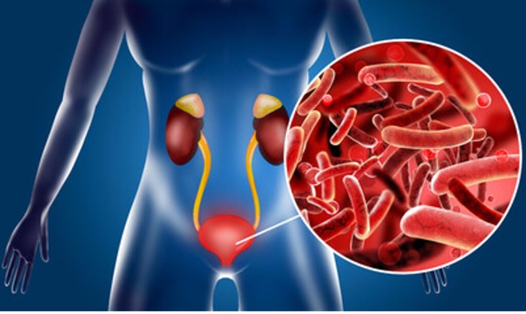 Urinary Tract Infections - Natural Health Group