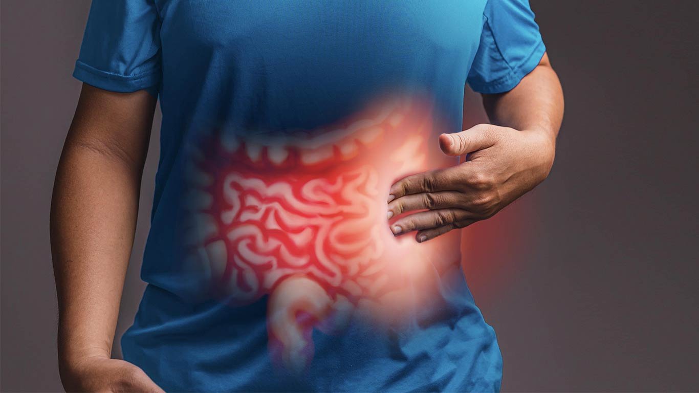 IBD (Irritable Bowel Disease) - Natural Health Group